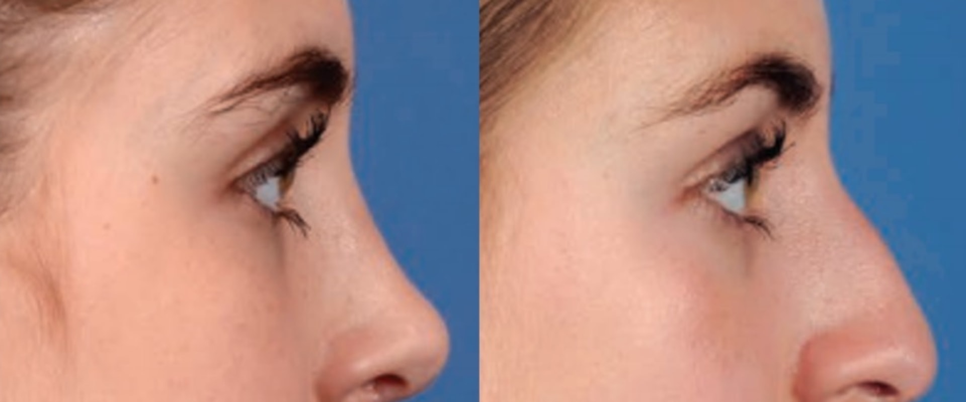 What is aesthetic surgery also called?